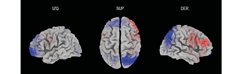 Temporal and spatial differences in the processing of lexical ...